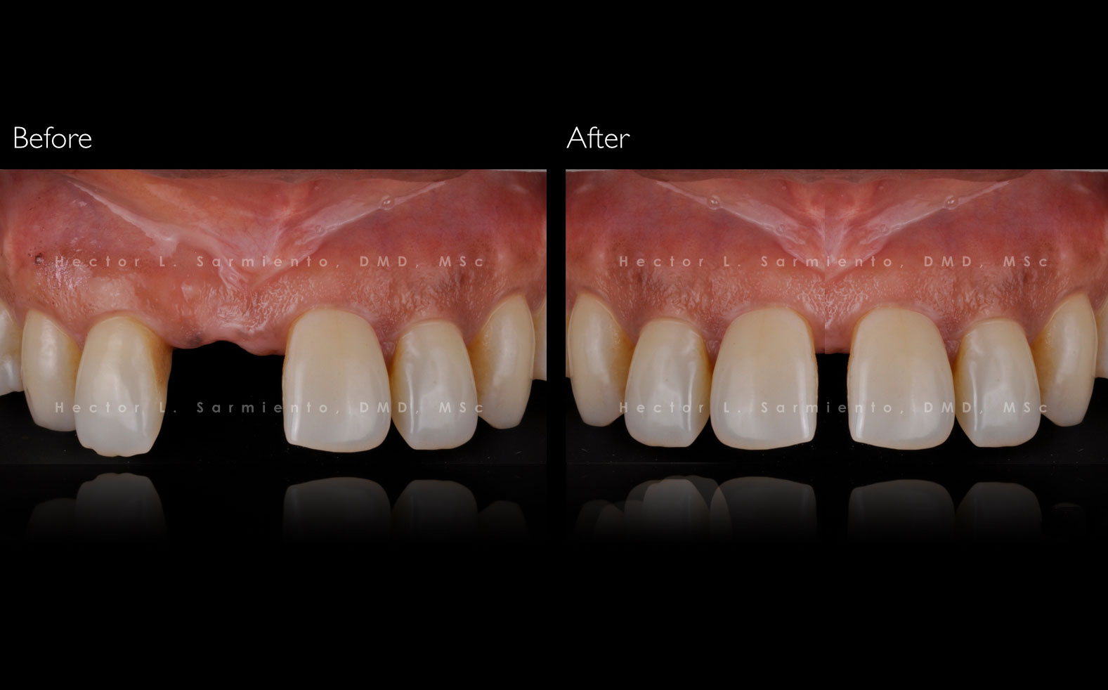 Restorative & Therapeutic - New York Periodontics