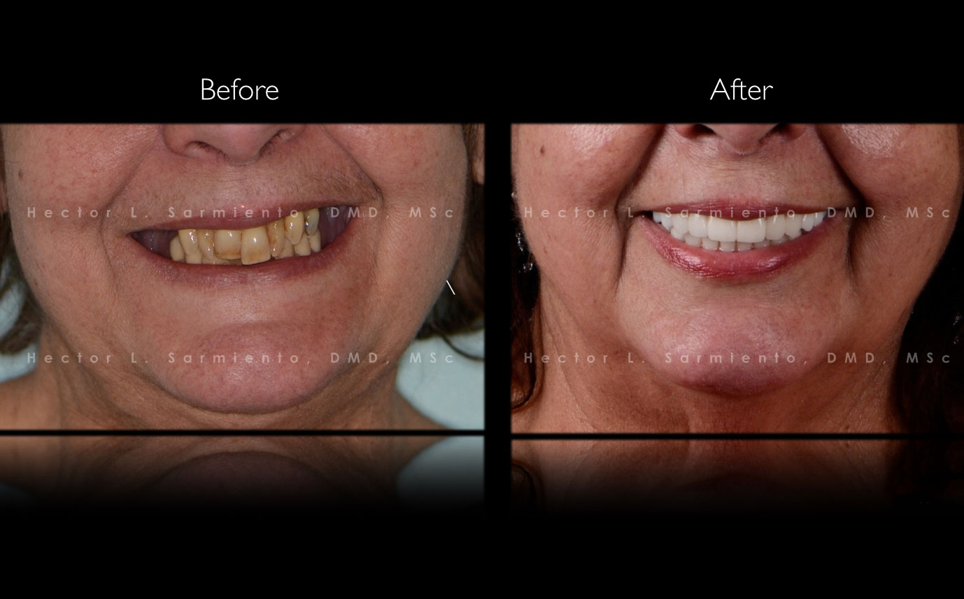 Restorative & Therapeutic - New York Periodontics