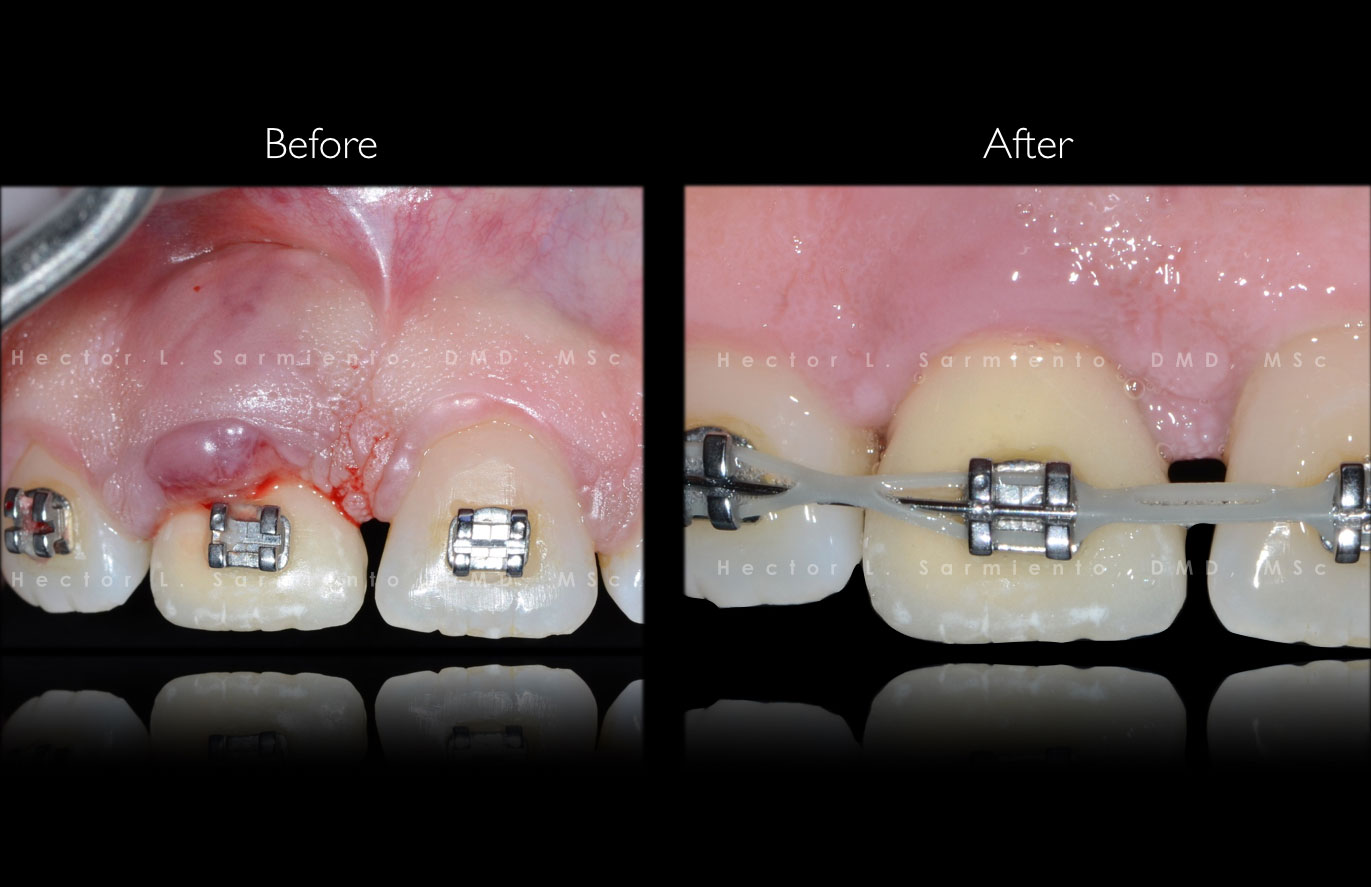 Restorative & Therapeutic - New York Periodontics